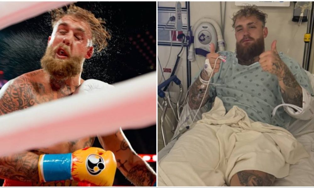 Jake Paul Recovery Process Revealed After Jaw Break vs Anthony Joshua ...